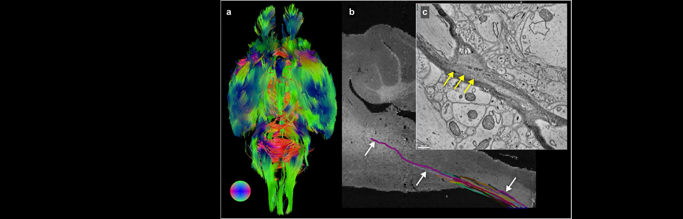 The Advanced Photon Source (APS)