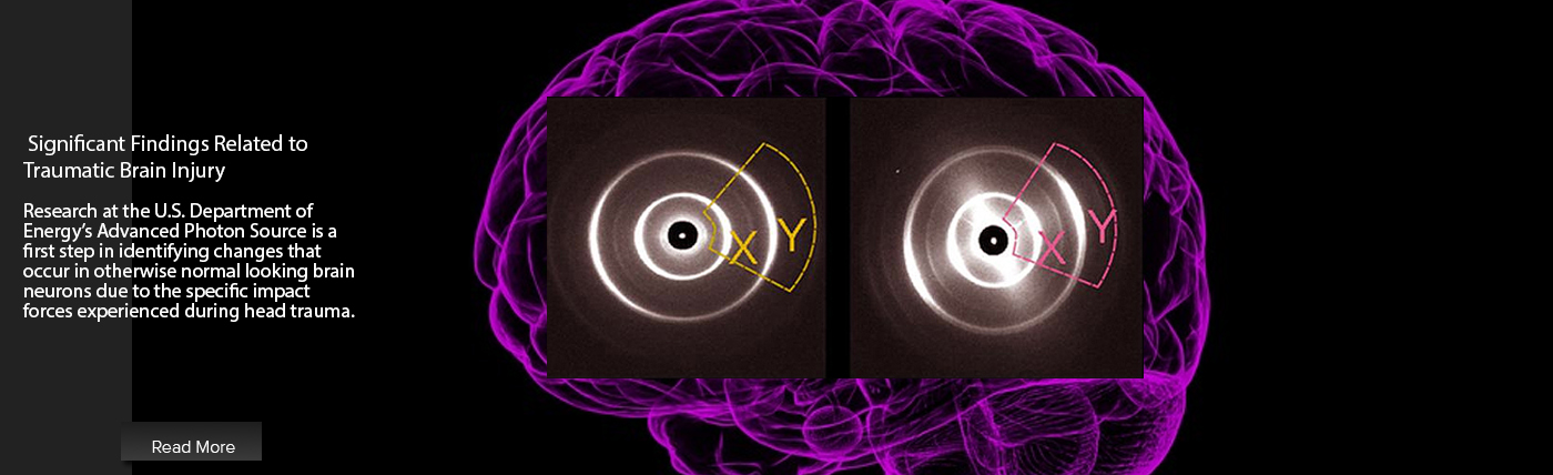 The Advanced Photon Source (APS)